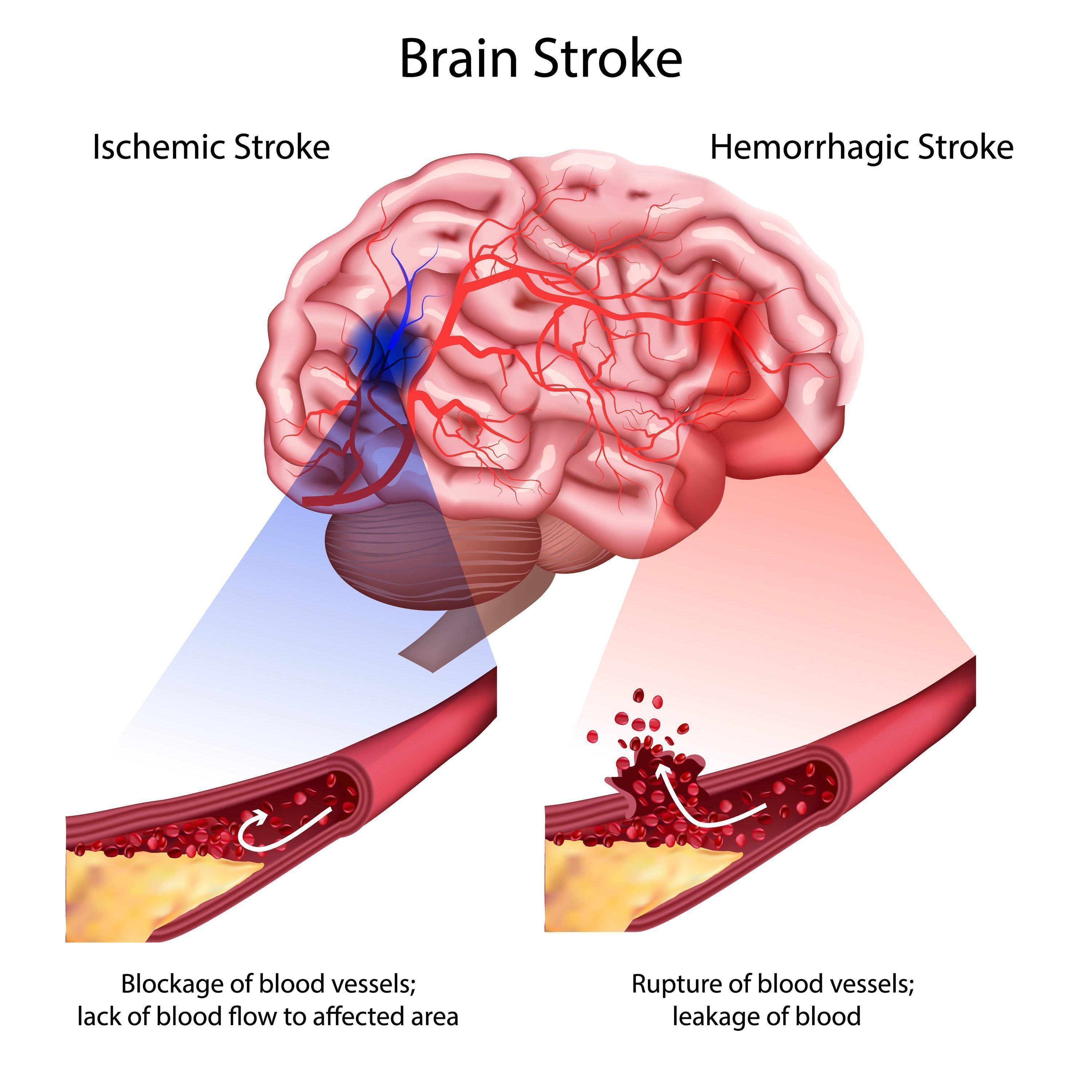 Nervous System Conditions And Treatments The Force For Health 